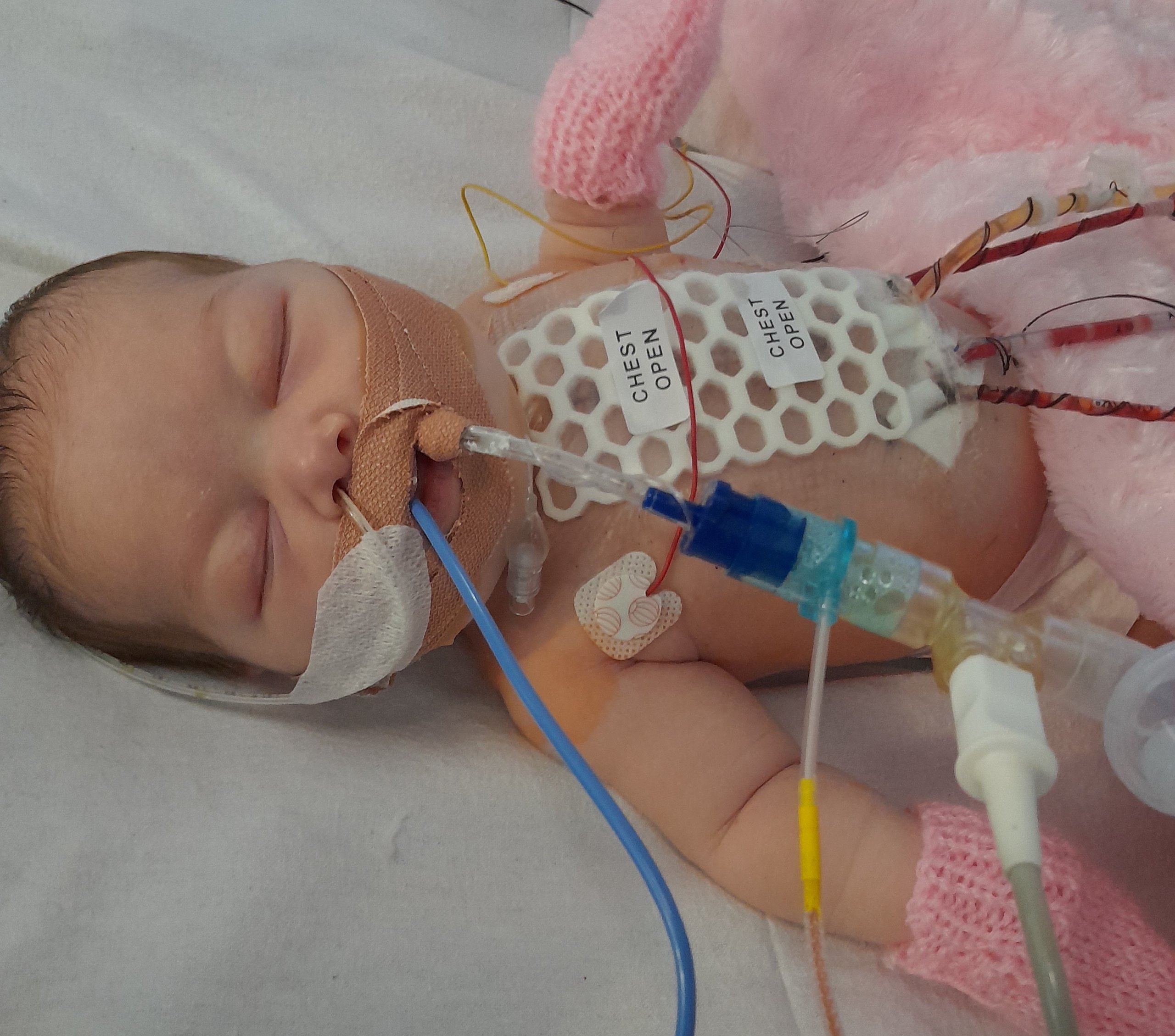 Callie-Mae after BBC Saving Lives in Leeds - CHSF